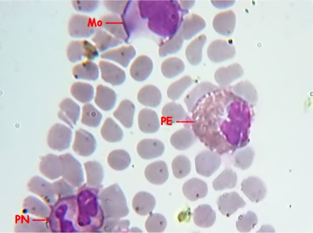 Eosinophiles Bas